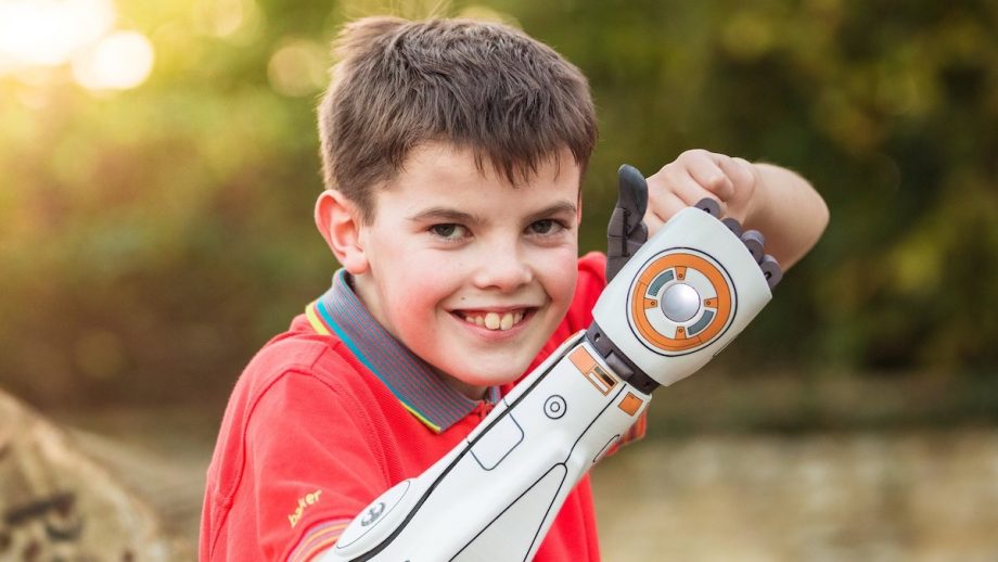 bionic arm Archives - Nerdist