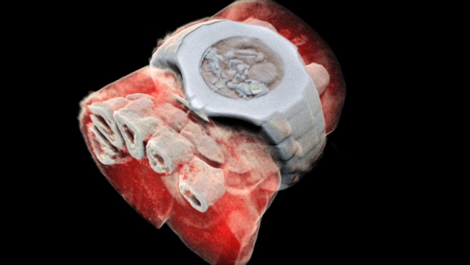 color x-rays Archives - Nerdist