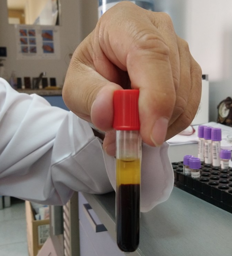 Answering 7 Key Questions About Serology Testing and COVID-19 - Nerdist