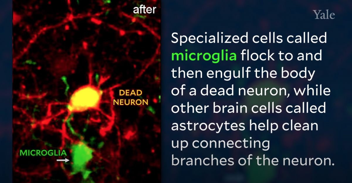 Researchers Share First Captured Image of Dying Neuron - Nerdist