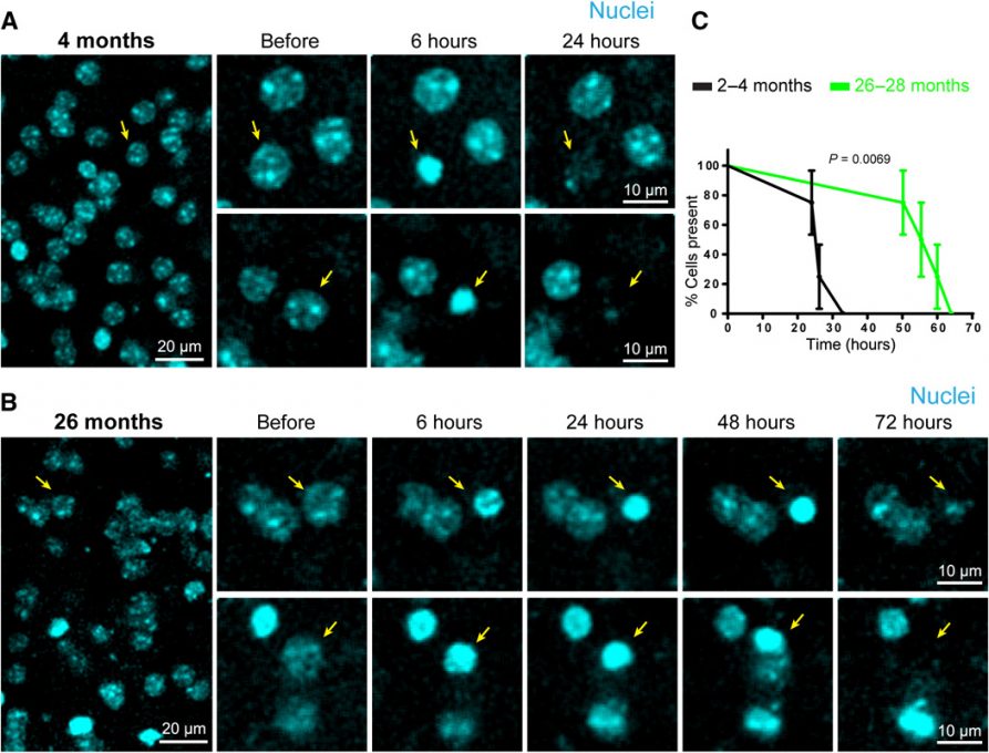 Researchers Share First Captured Image of Dying Neuron - Nerdist