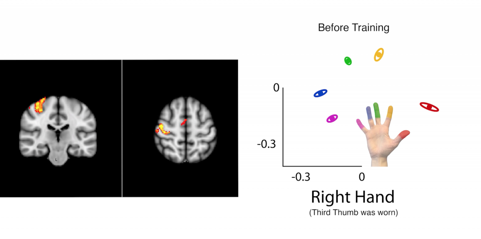 Robotic Thumb Is an Extra Appendage That Rewires Users' Brains - Nerdist