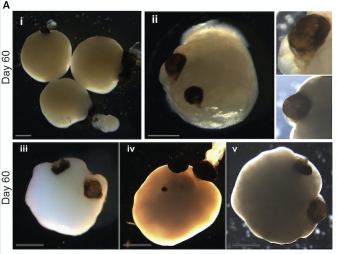 Lab-Grown Brain 'Organoids' Now Have Primitive Eyeballs - Nerdist