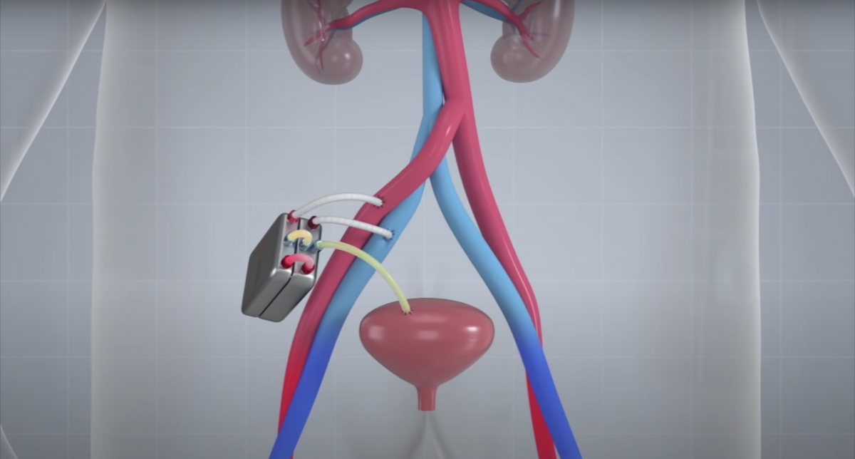 Award Winning Artificial Kidney Is a Biomedical Breakthrough - Nerdist