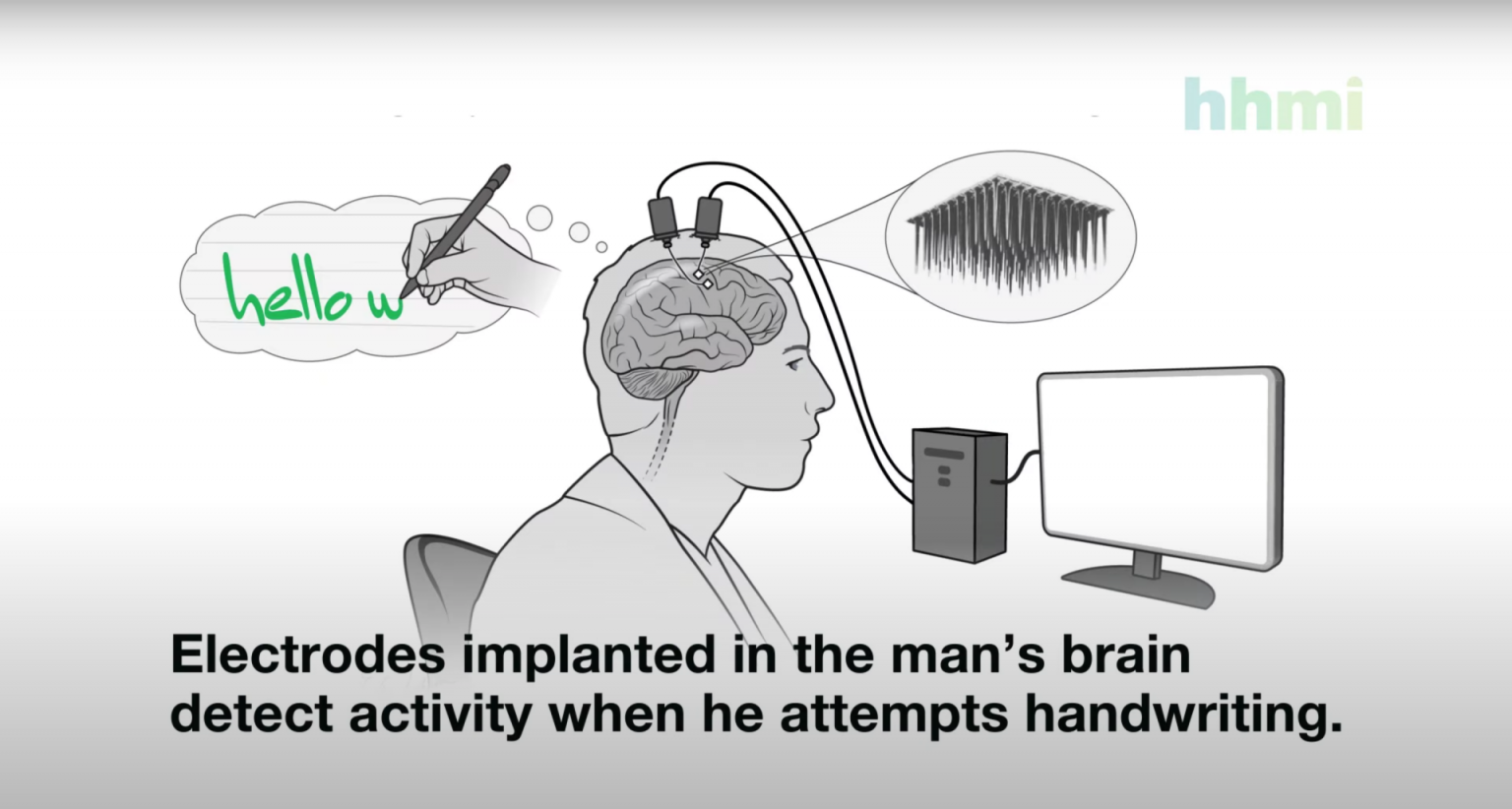 Brain-Computer Interface Turns Mental Writing into Text - Nerdist