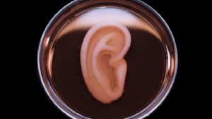 The First 3D-Printed Human Ear Transplant Was Successful - Nerdist