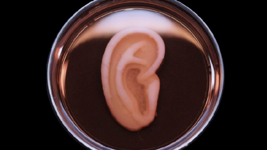 The First 3D-Printed Human Ear Transplant Was Successful - Nerdist