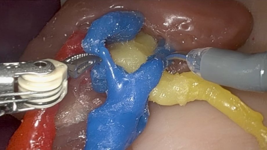 3D Printing Tech Lets You See An Operation On Your Own Organs Nerdist